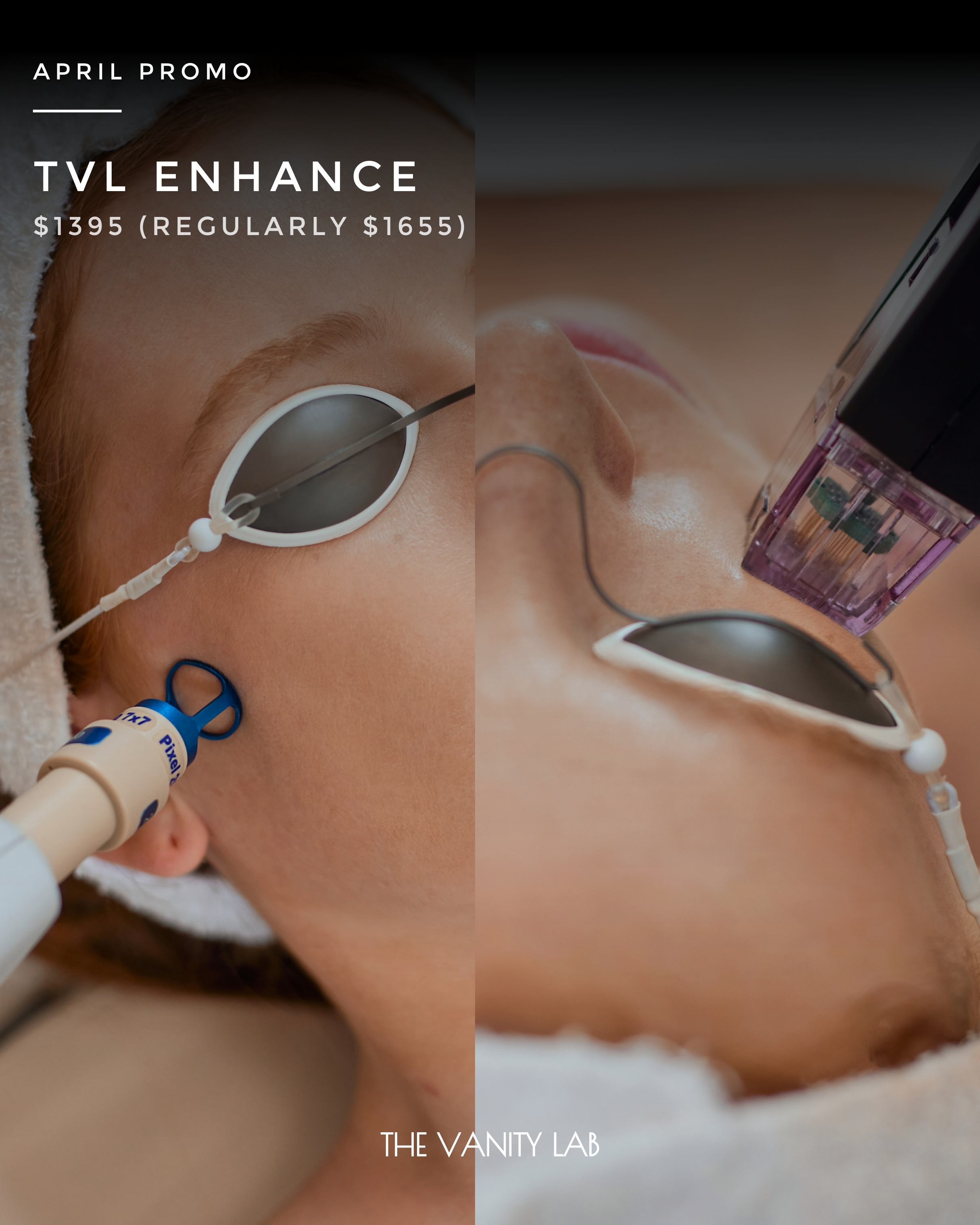 TVL Enhance - April Special | The Vanity Lab